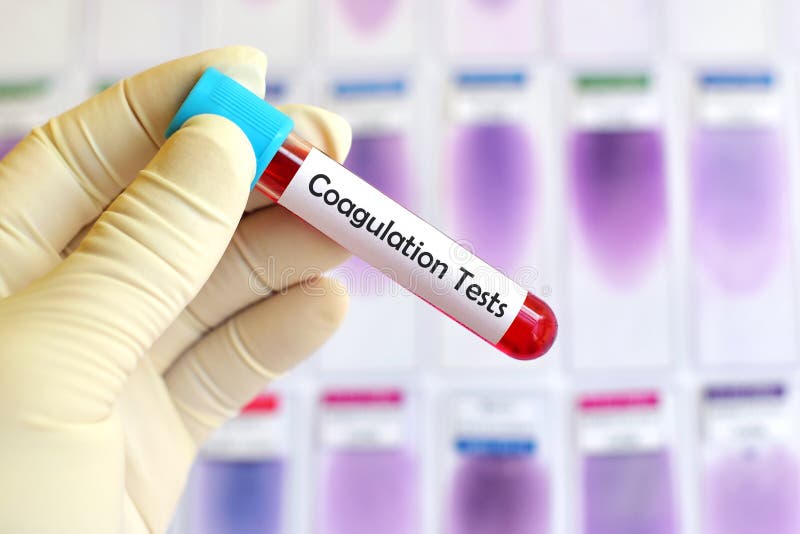 Sangre Para La Prueba De La Coagulación Foto de archivo - Imagen de ...