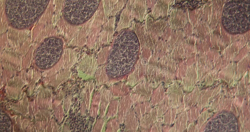 Sarcocyst Parasites in Monkey Tissue Stock Footage - Video of clinic ...