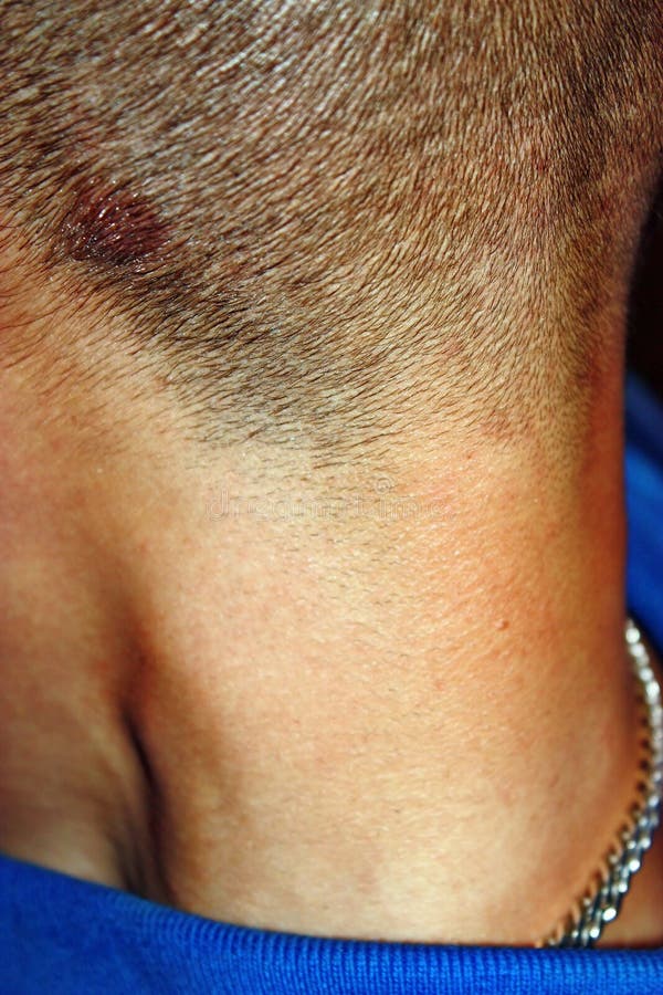 2,050 Scab Photos - Free & Royalty-Free Stock Photos from Dreamstime