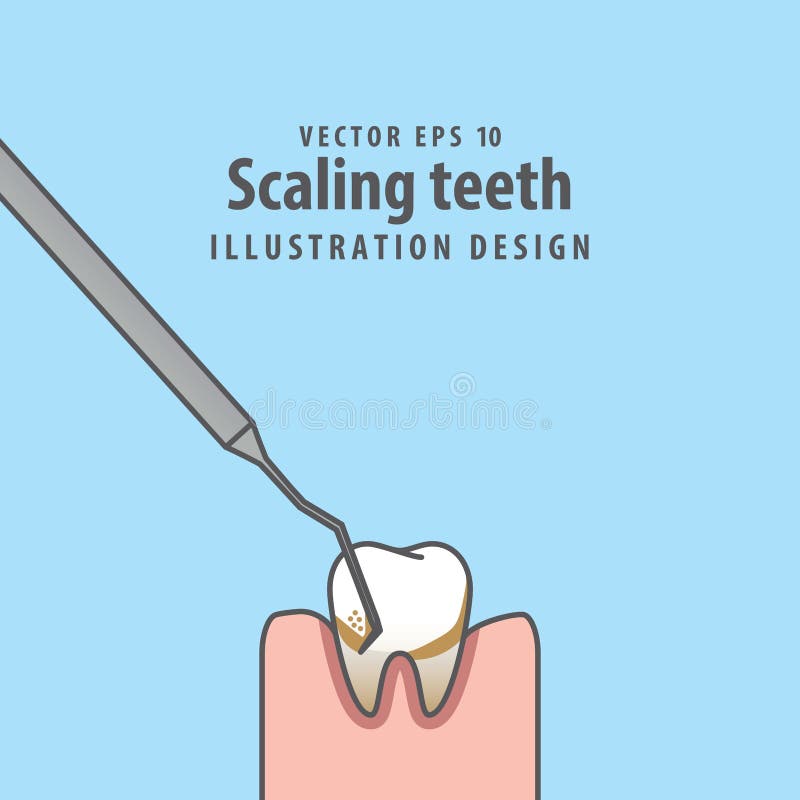 Scaling Teeth Illustration Vector on Blue Background. Dental Con Stock ...