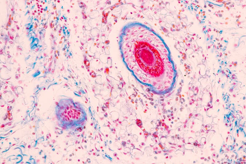 Scalp and Hair Follicles of Human Under the Microscope. Stock Image ...