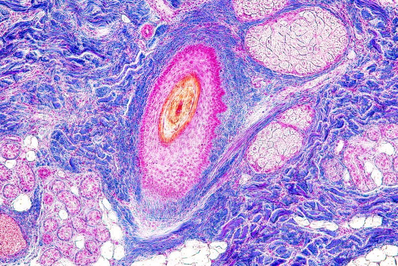 Scalp and Hair Follicles of Human Under the Microscope. Stock Image ...