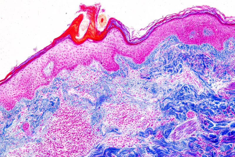 Scalp and Hair Follicles of Human Under the Microscope. Stock Image ...