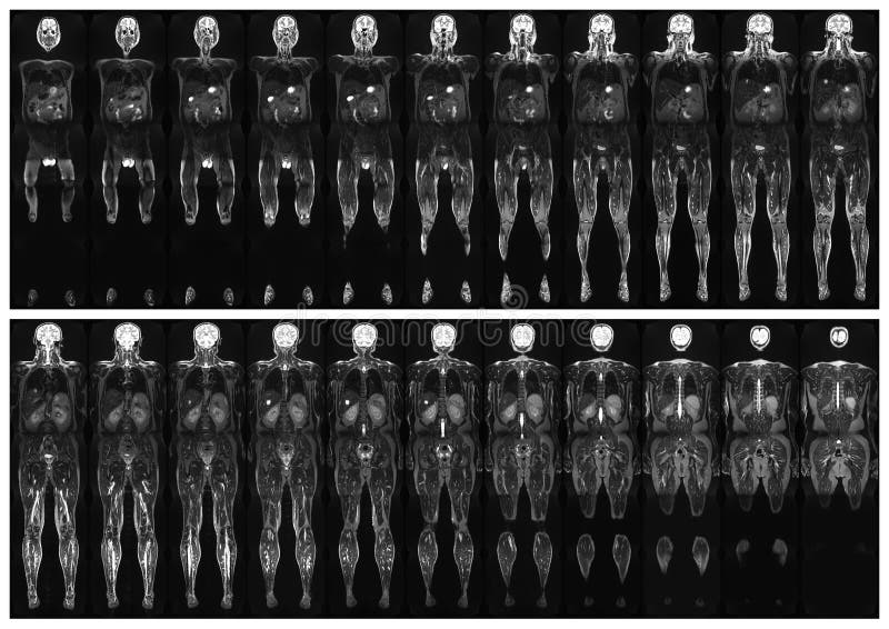 Scan the human body stock photo. Image of illness, lumbar - 34804650