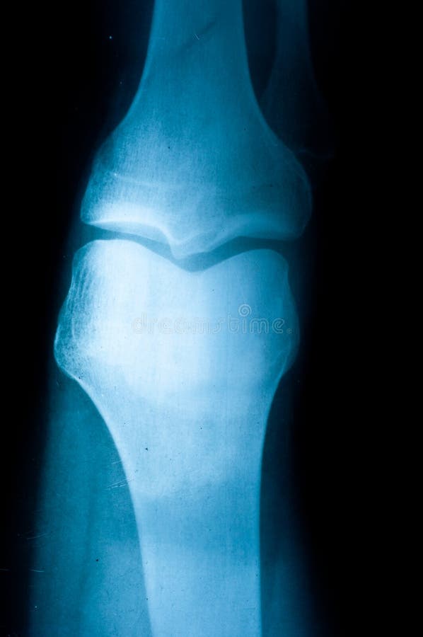 A scan of the human leg stock image. Image of examination - 17181671