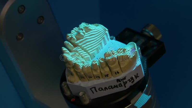 Scanning of Casts on a 3D Scanner for the Manufacture of Dentures ...