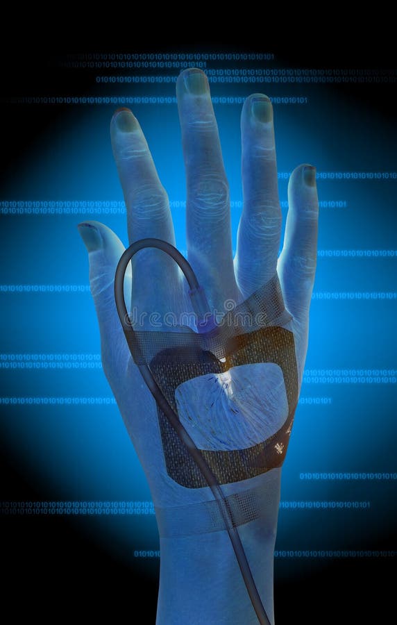 Scanning of patients hand stock image. Image of fingerprint - 32094887