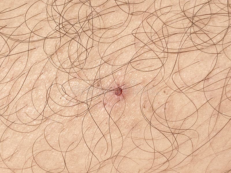 Scar on human body stock photo. Image of closeup, head - 254621020