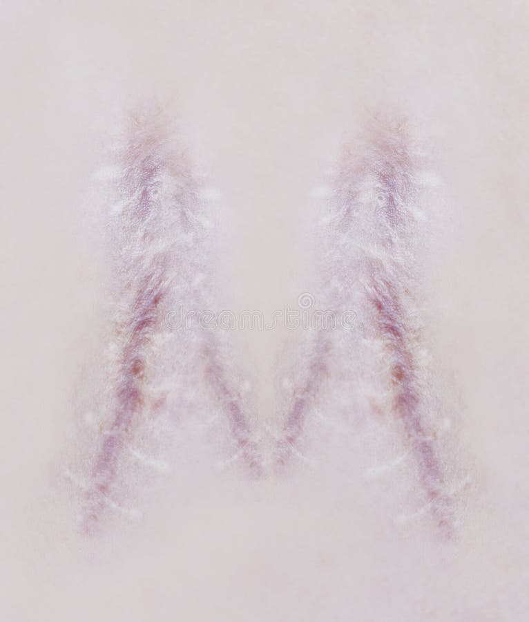 Scar Letter M on Human Skin Stock Image - Image of injury, copy: 38832895