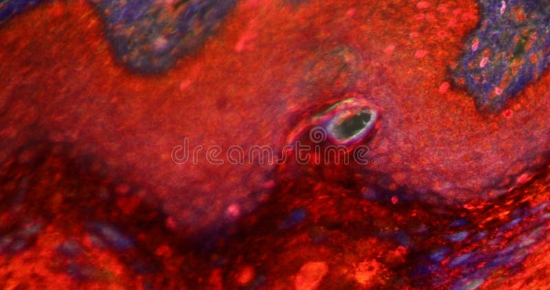 Scar tissue stock footage. Video of skin, cells, digestion - 204808242