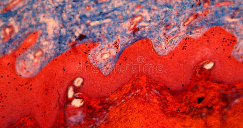 Scar tissue stock footage. Video of skin, cells, digestion - 204808242