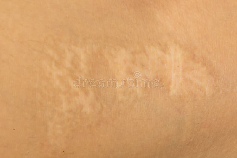 Derma Blading Stock Photos - Free & Royalty-Free Stock Photos from ...