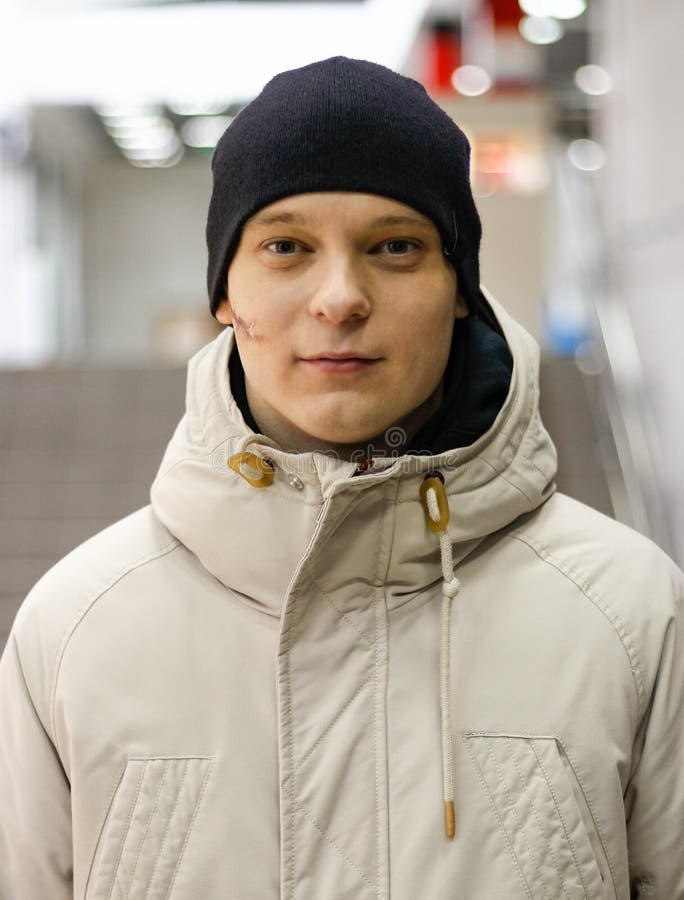 Scarface. a Young Man with a Big Scar on His Face Stock Image - Image ...