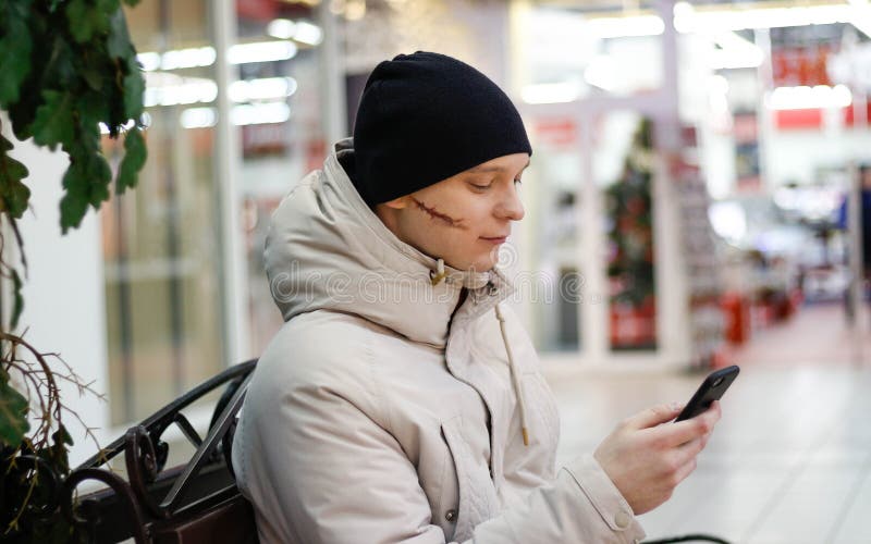 Scarface. a Young Man with a Big Scar on His Face Stock Image - Image ...