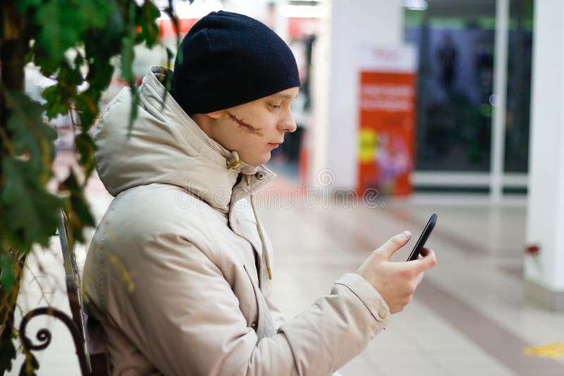 Scarface. a Young Man with a Big Scar on His Face Stock Image - Image ...