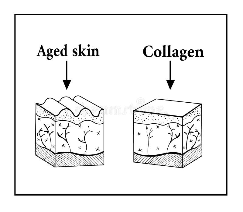 Schema Der Haut Unter Einfluss Des Kollagens Vektor Abbildung ...