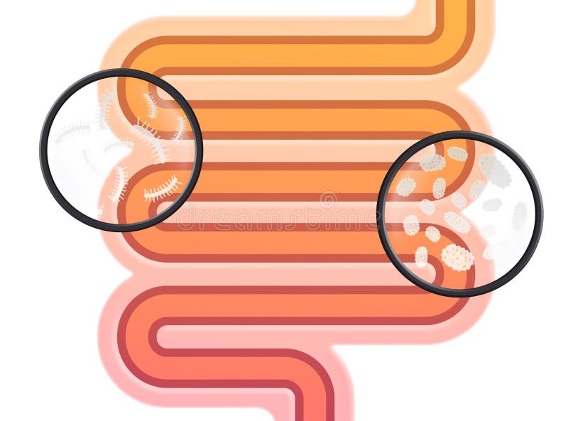 Schematic Illustration of Human Intestines Stock Illustration ... Schematic Illustration of Human Intestines Stock Illustration ...
