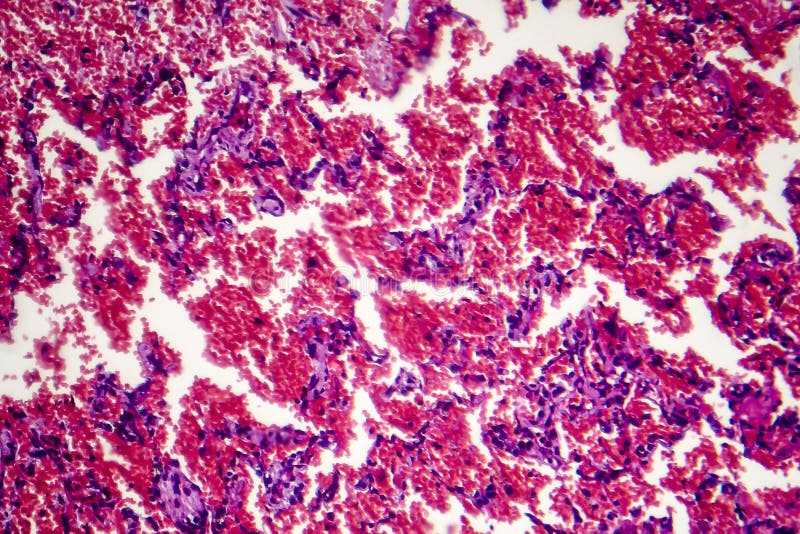 Scherp longoedeem stock foto. Image of scherp, vergroting - 120906780