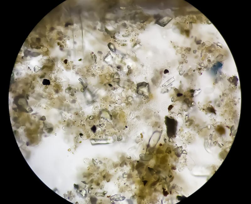 Schistosoma Parasite and Ova in Human Urine Specimen Under Microscope ...