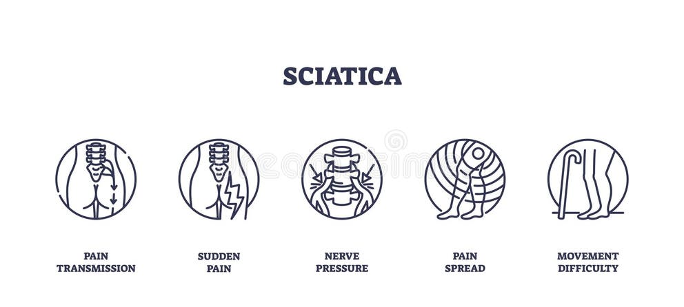 Sciatica Icons Outline Key Concepts Like Pain Transmission, Nerve ... Sciatica Icons Outline Key Concepts Like Pain Transmission, Nerve ...