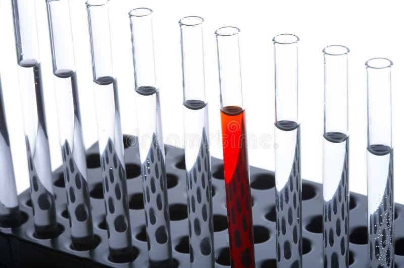 Blood test stock photo. Image of interacting, team, test - 778512