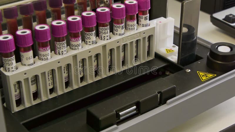 Medical Test Sample Tubes Beaker with Analyzes. Analyzing Samples ...
