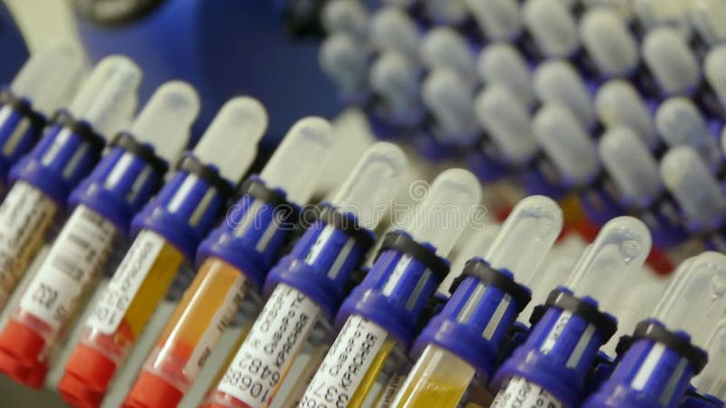 Medical Test Sample Tubes Beaker with Analyzes. Analyzing Samples ...