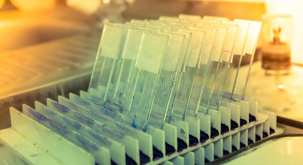 Science Medical Glass Microscope Slide with Sample Stock Photo - Image ...