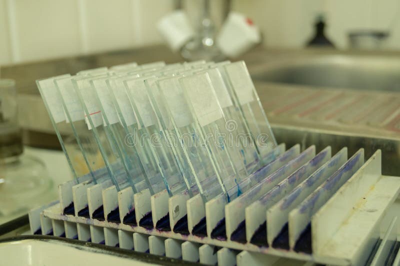 Science Medical Glass Microscope Slide with Sample Stock Image - Image ...