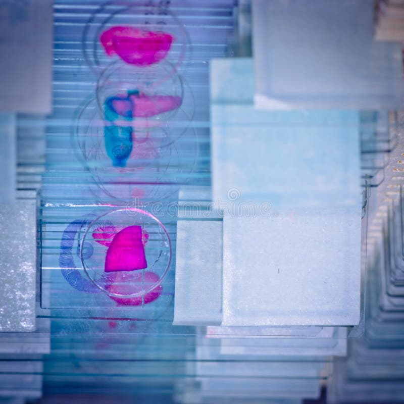 Dropped Blood Onto Microscope Slide 1 Stock Photo - Image of drop ...