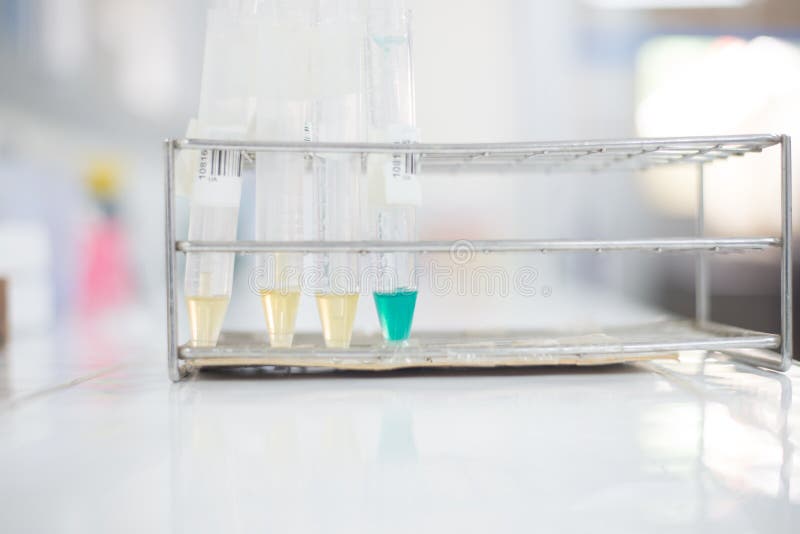 107 Urine Analyzer Stock Photos - Free & Royalty-Free Stock Photos from ...