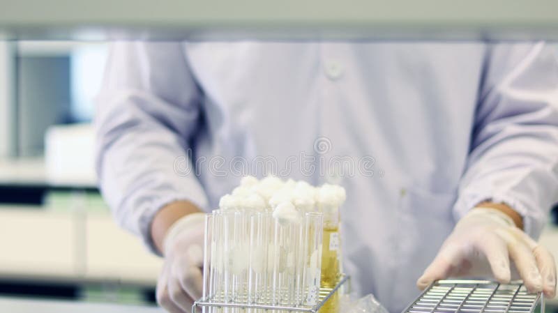 Microbiology Analysis E.Coli in Food Sample Use Most Probable Number ...