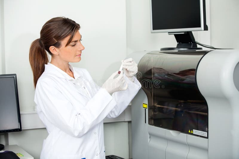 Scientist Analyzing Blood Sample for Coagulation Stock Photo - Image of ...