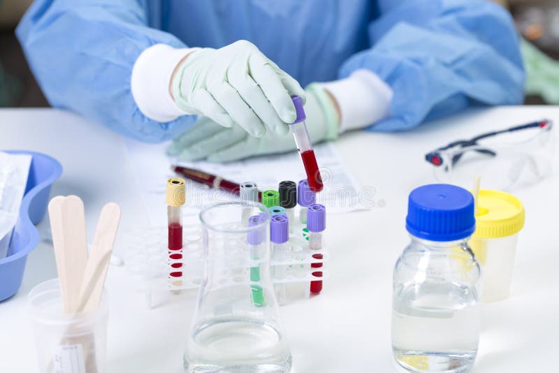 Scientist Analyzing Test Samples in a Laboratory Stock Image - Image of ...