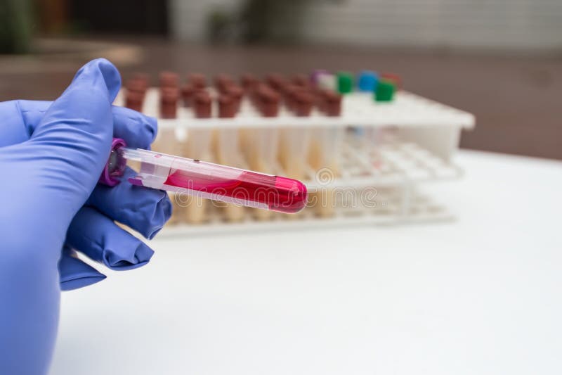 Scientist arrange samples stock image. Image of glove - 100551785