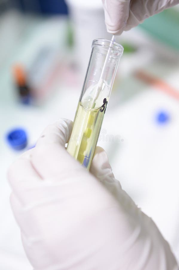 Scientist Doing Chemical Test Stock Image - Image of biology, blood ...