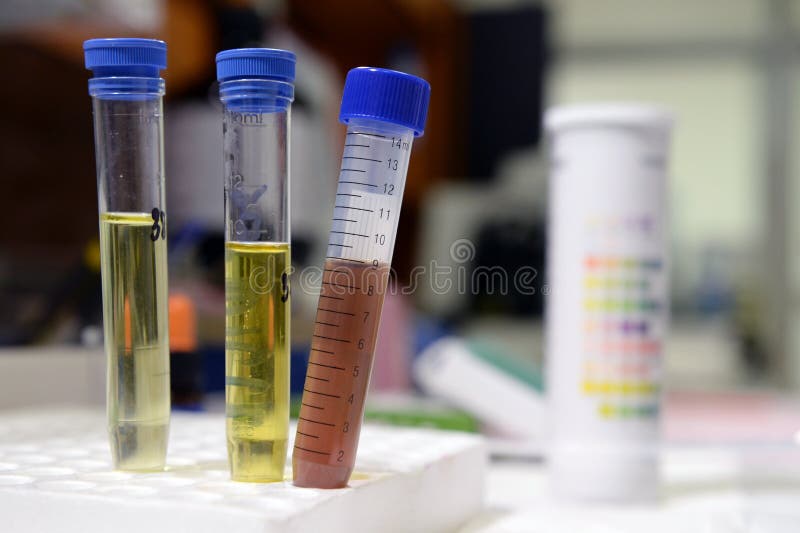 Scientist Doing Chemical Test Stock Photo - Image of microbiology ...