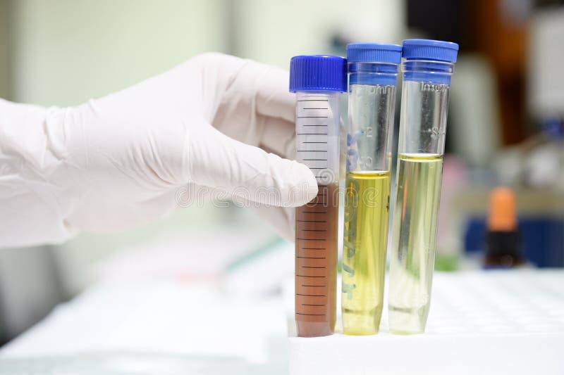 Scientist Doing Chemical Test Stock Image - Image of blood, doctor ...
