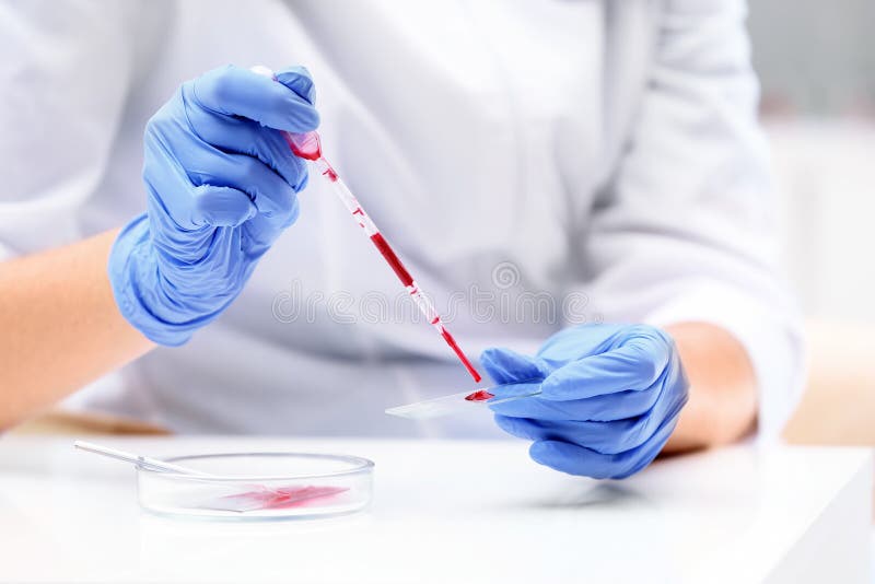 Scientist Dripping Blood Sample on Glass Stock Photo - Image of ...