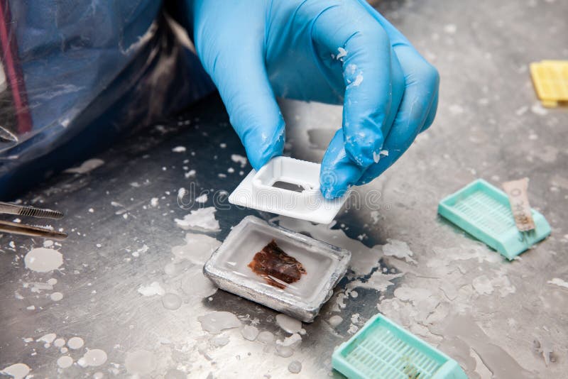 Scientist Embedding Tissues in Paraffin Blocks for Sectioning ...