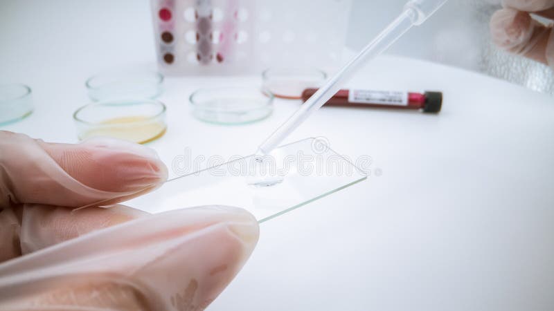 Scientist Experimented in Lab. Pipette Adding Fluid of Microscope Slide ...