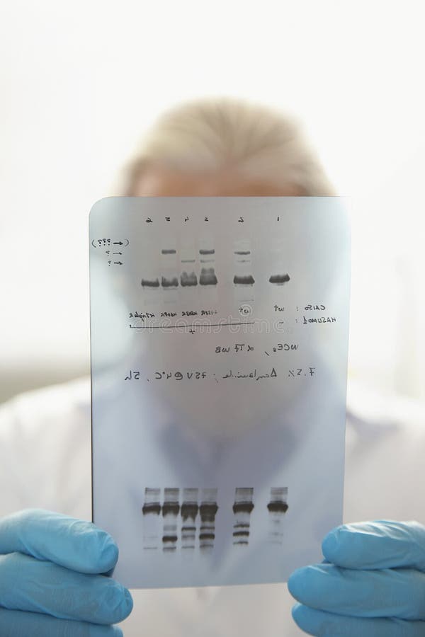 Scientist Holding DNA Test Results in Front of Face Stock Photo - Image ...