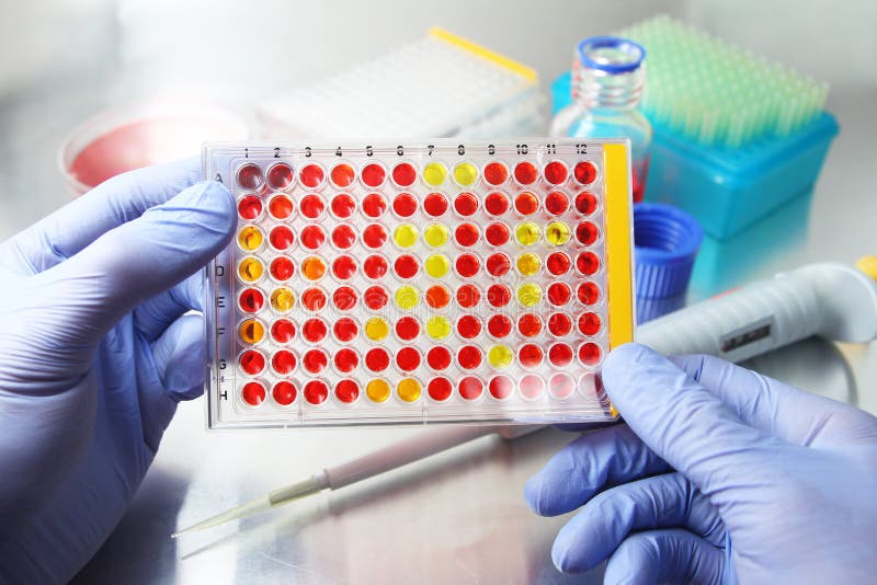 96 Well Plate with Samples for Biological Analysis. Microplate for ...