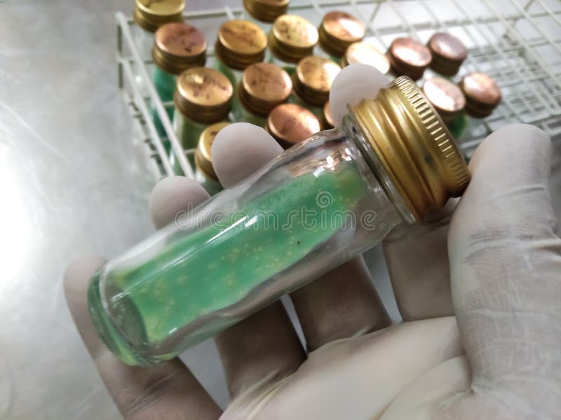 Scientist Holding Solid Lowenstein–Jensen Agar Medium Bottle Stock ...