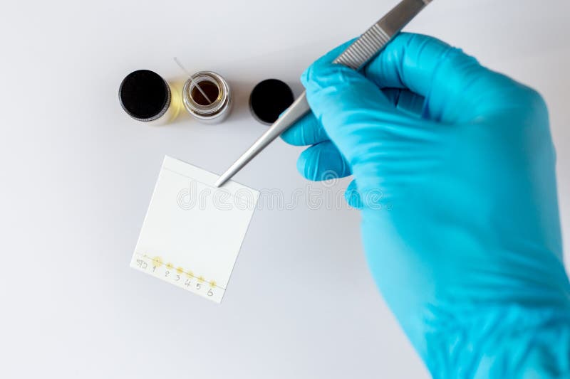 Tlc Mobile Phase Stock Photos - Free & Royalty-Free Stock Photos from ...