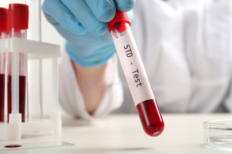 Scientist Holding Tube with Blood Sample and Label STD Test at White ...
