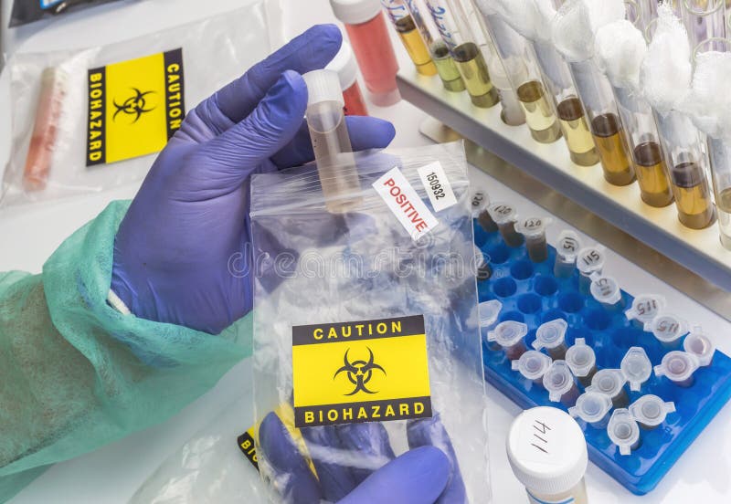 213 Biohazard Sample Bag Stock Photos - Free & Royalty-Free Stock ...