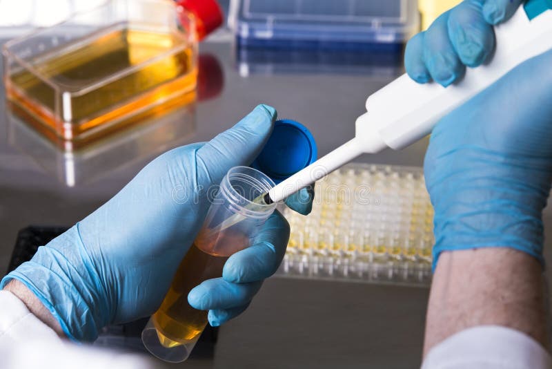 Scientist Pipetting a Sample from a Test Tube for a Clinical Test Stock ...