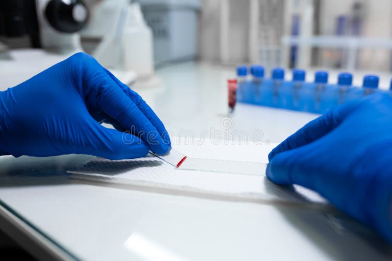 Scientist Prepare Blood Sample for Research on Microscope. Placing ...