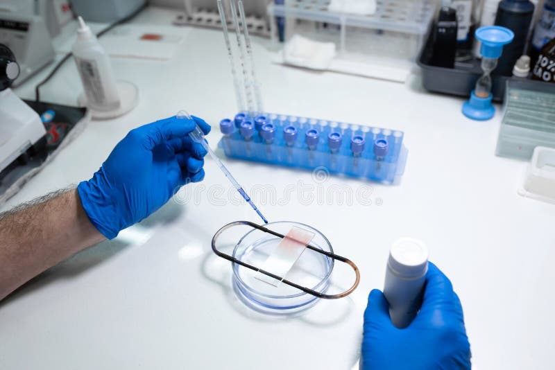 Scientist Prepare Blood Sample for Research on Microscope. Placing ...